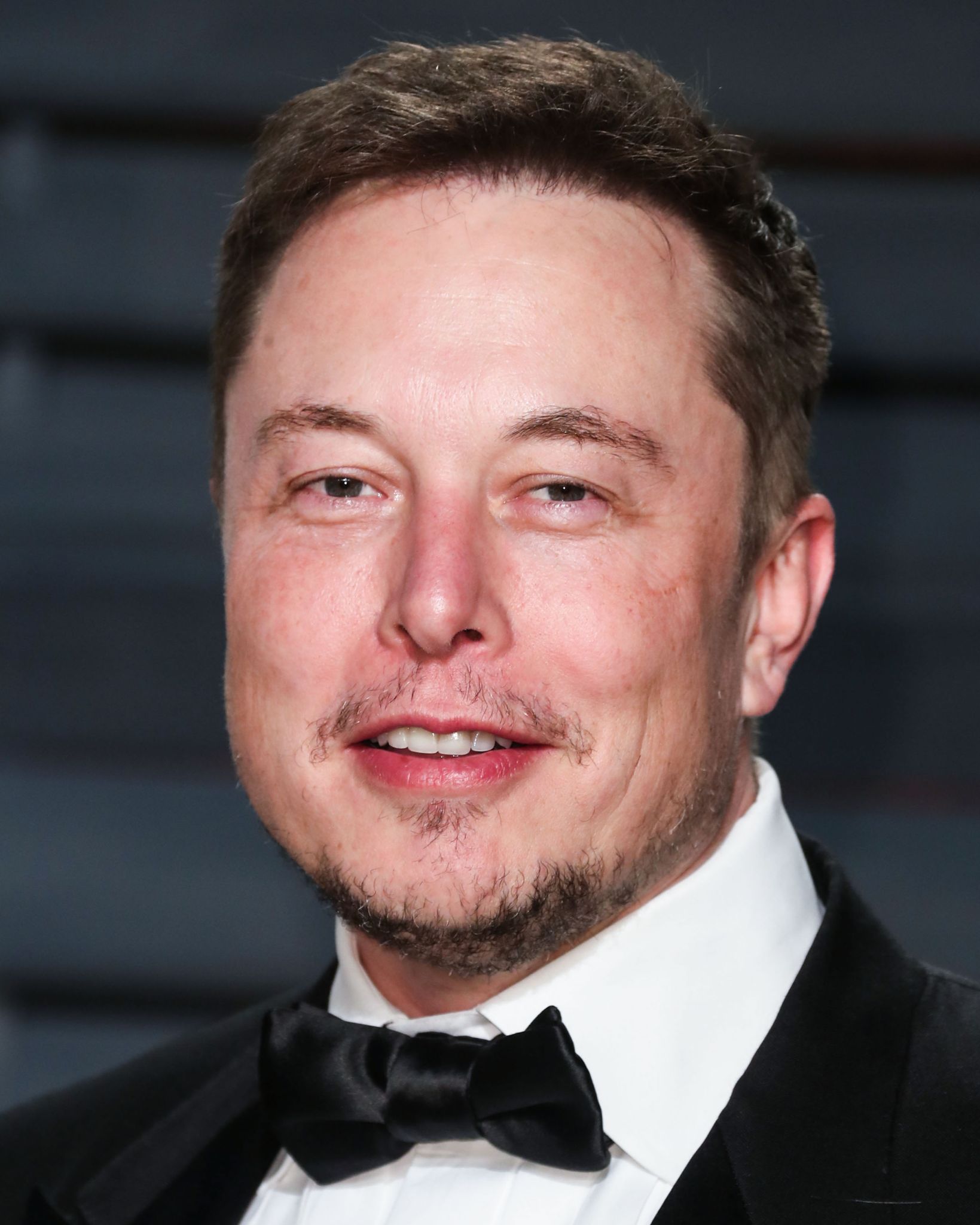 Would You Want Elon Musk’s Brain Chip in Your Head to Stream Music ...